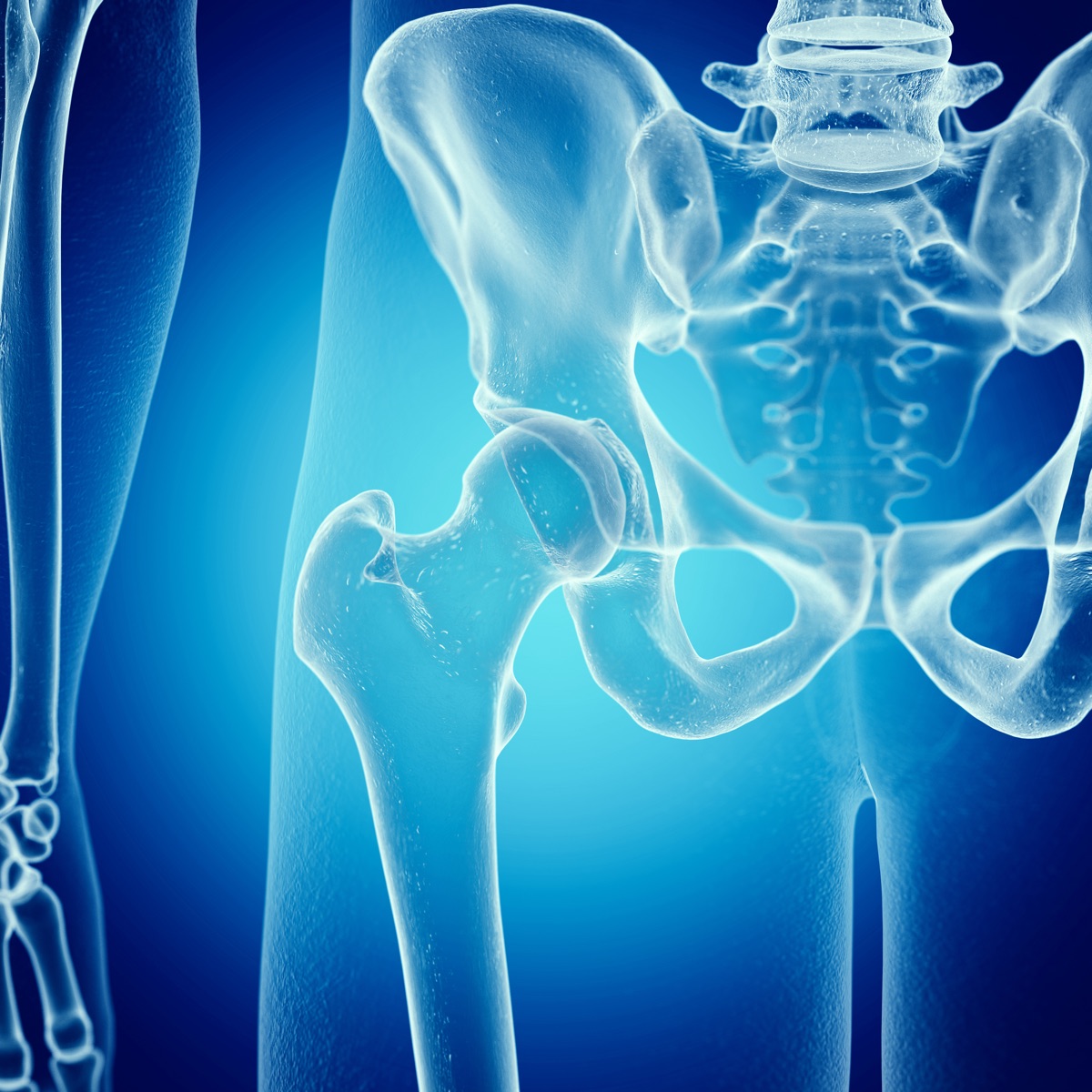 Hip Replacement Costs | Surgery, Insurance & Out-of-Pocket Guide